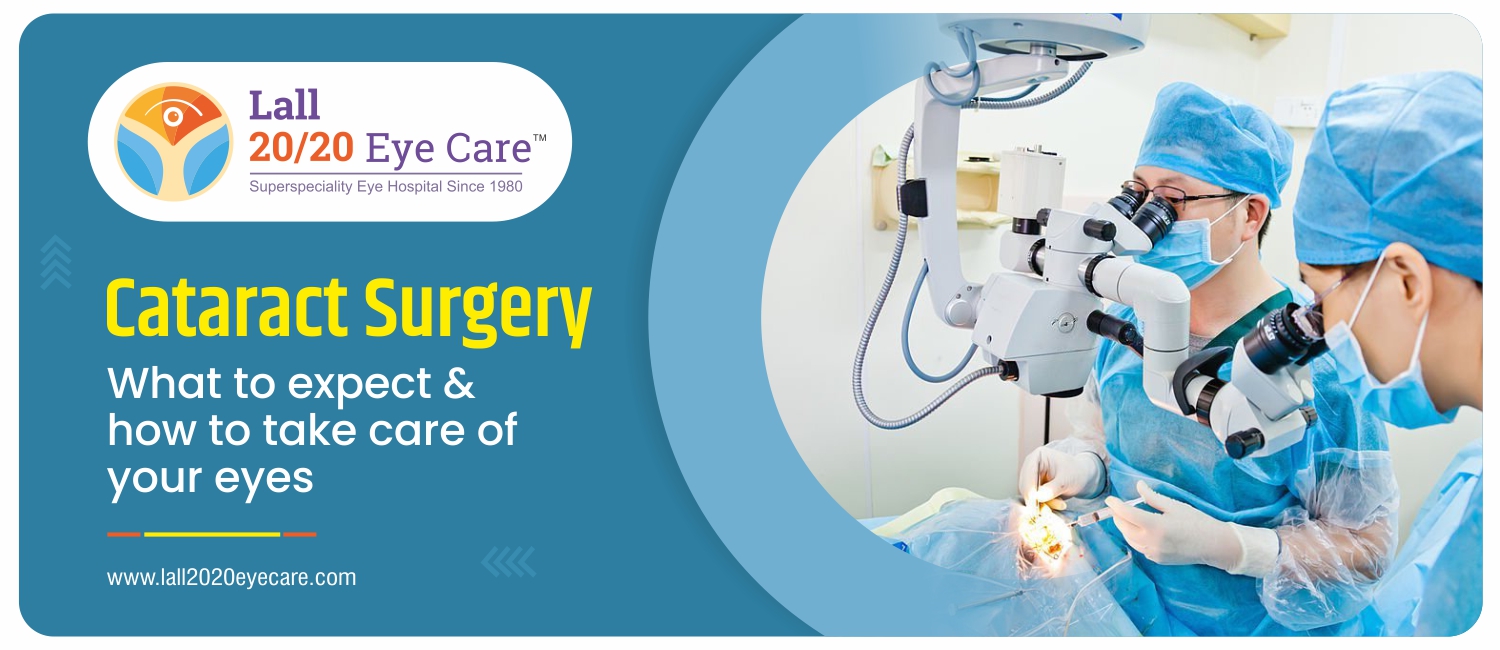 Everything You Need to Know About Catract Surgery